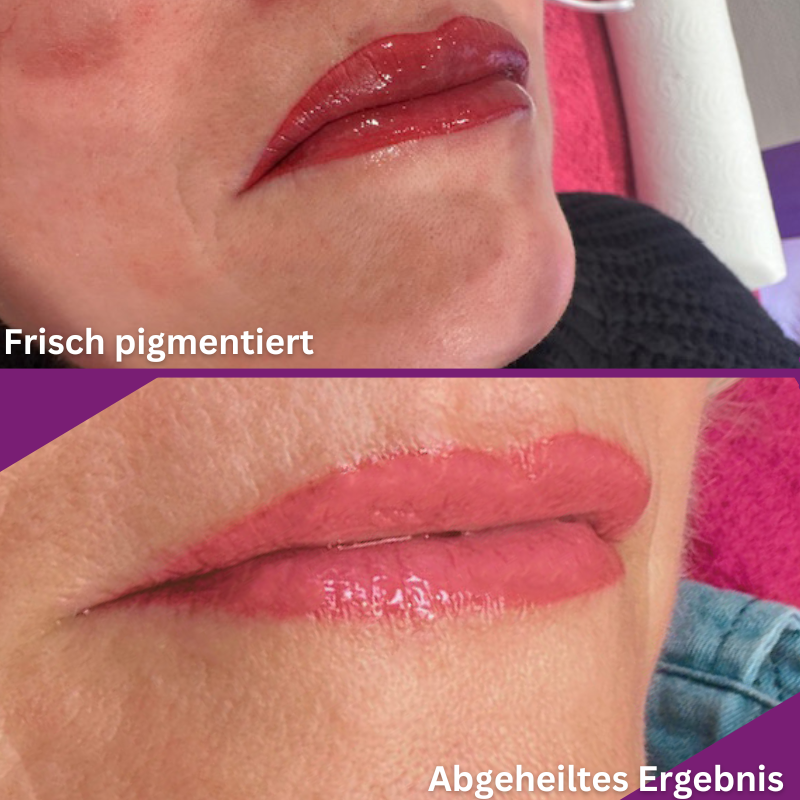 Lippenpigmentierung Vorher Nachher